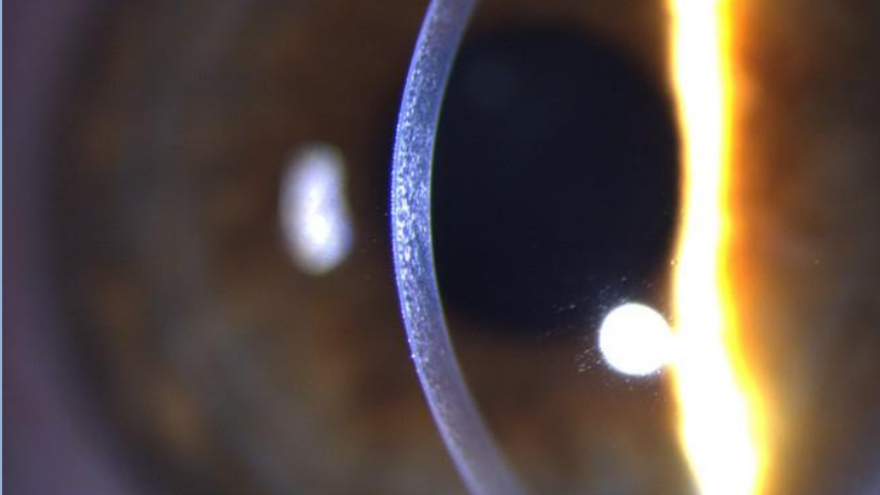 Haag-Streit Slit lamps